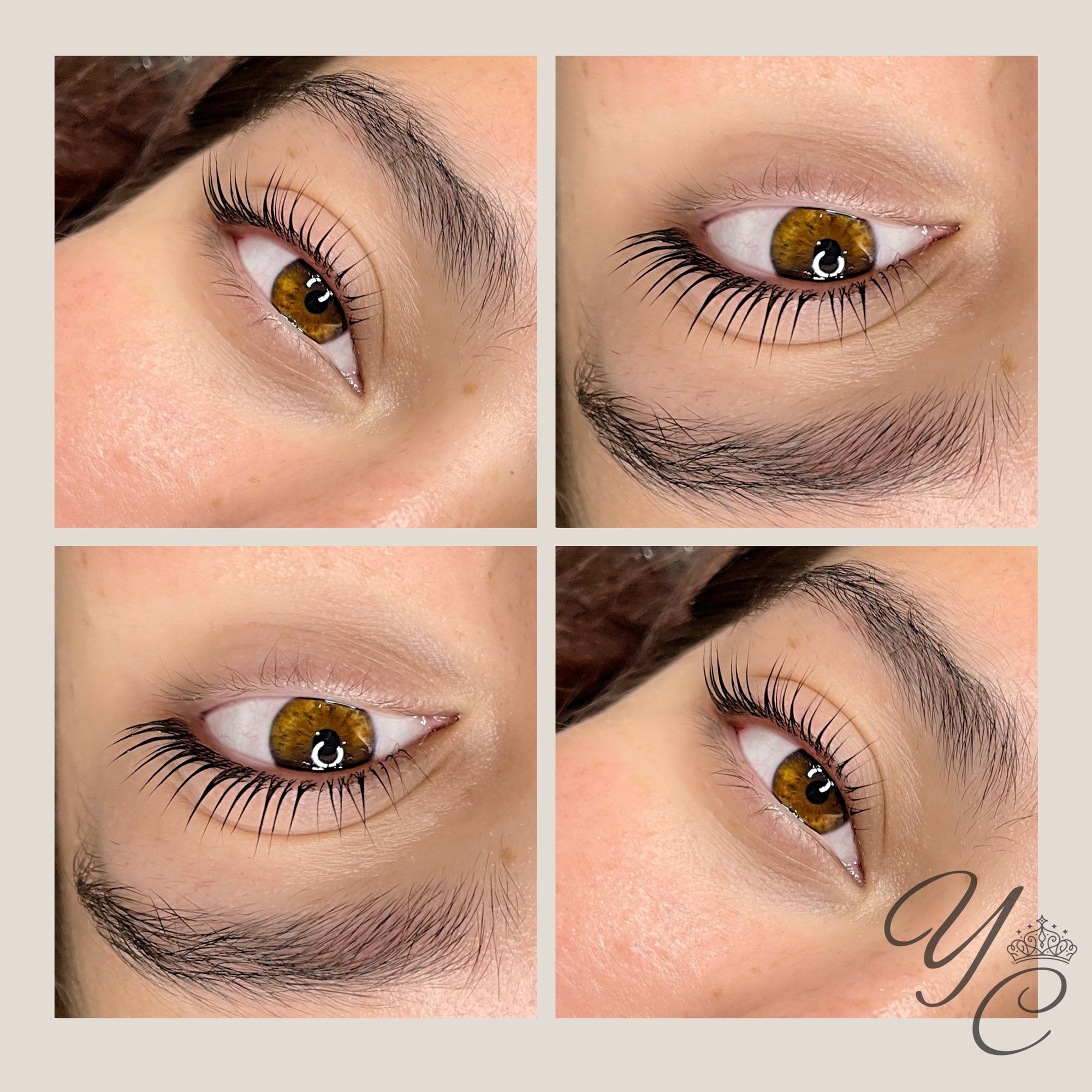 The Best You Before & After – You On Crown