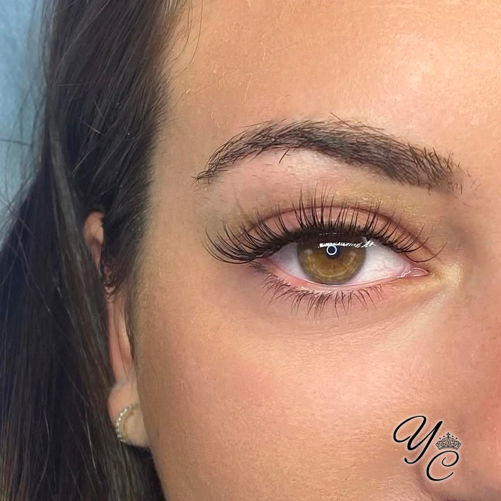 The Best You Before & After – You On Crown