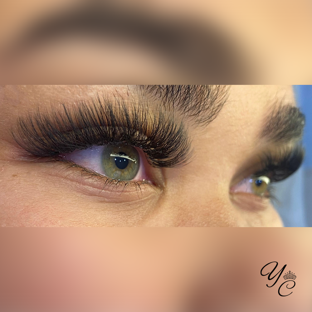 The Best You Before & After – You On Crown