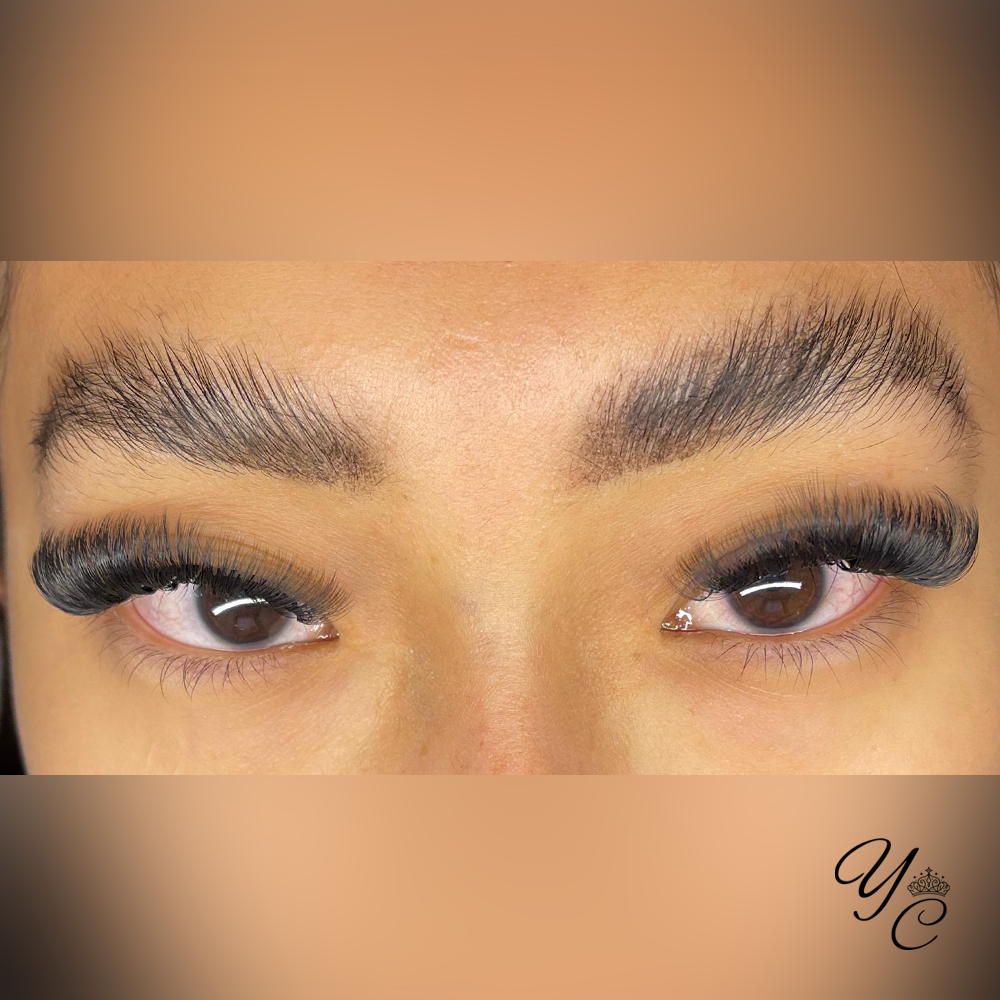 The Best You Before & After – You On Crown