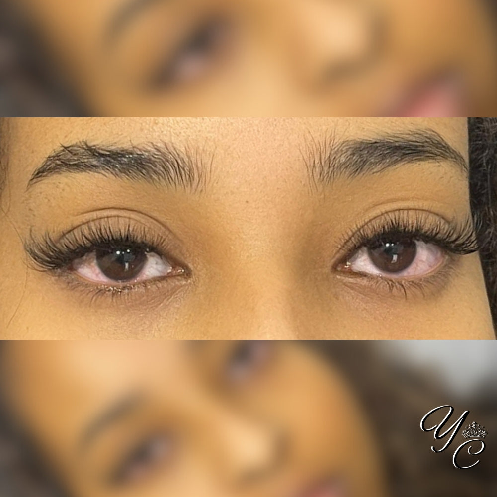 The Best You Before & After – You On Crown