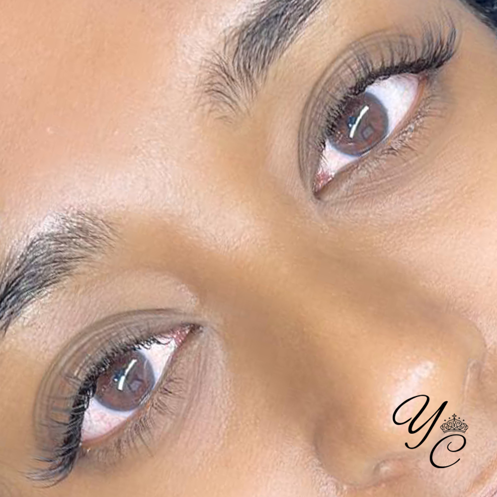 The Best You Before & After – You On Crown