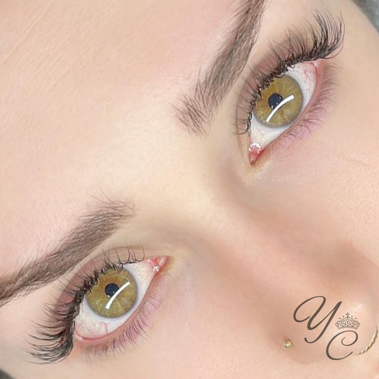 The Best You Before & After – You On Crown