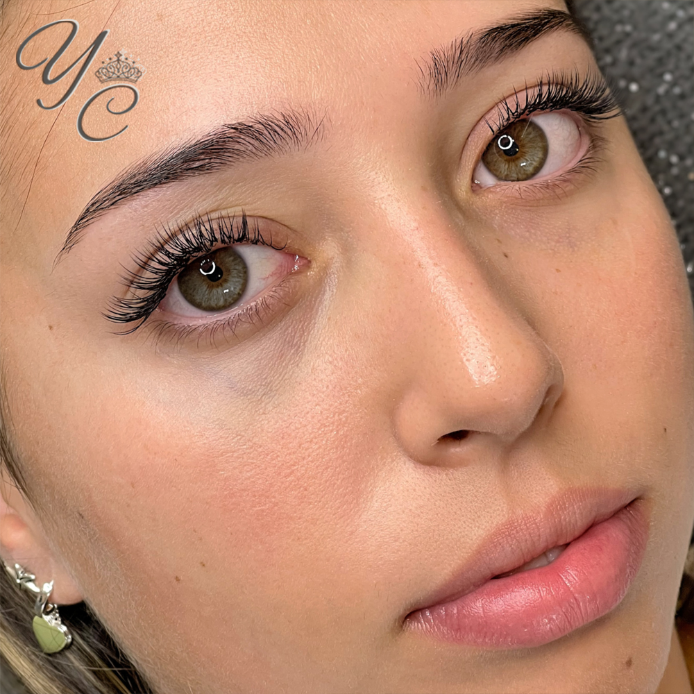 The Best You Before & After – You On Crown